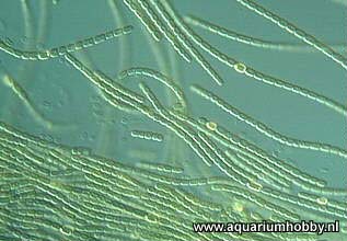 Welke voedingsbodems kan met gebruiken voor het laten groeien van ...