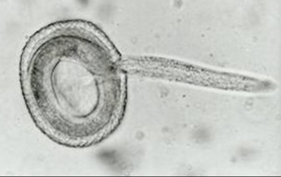 Hoe ziet een spoelwormlarve eruit onder een microscoop? - GoeieVraag