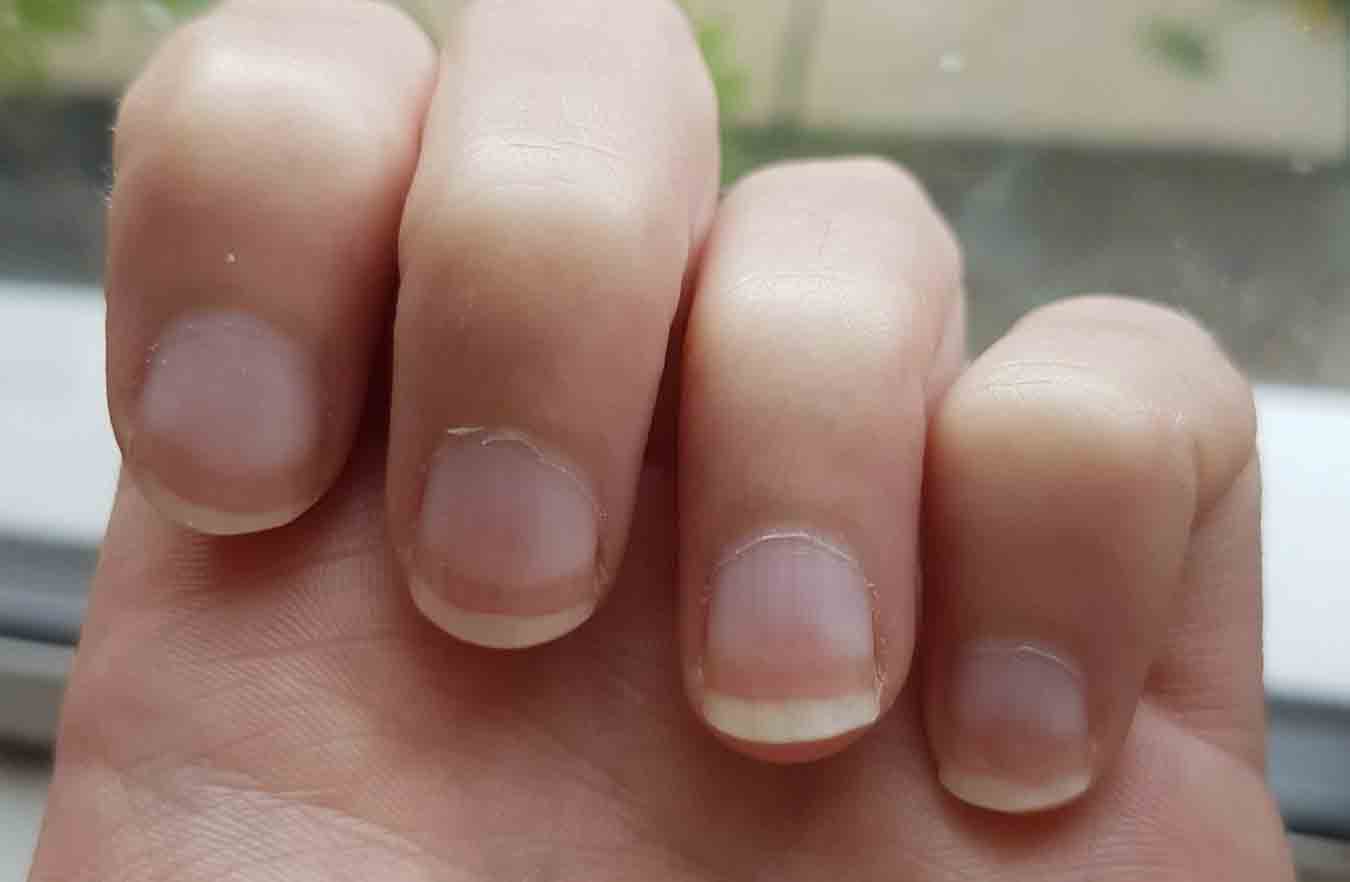 Zijn dit Terrys nails en moet ik mij zorgen maken? - GoeieVraag